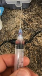 Ultrasound-Guided Lymph Node Culture - SonoPath