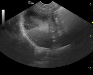Gallbladder Motility Study - SonoPath