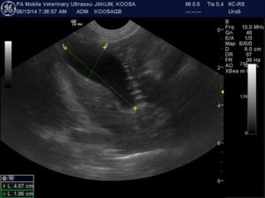 Gallbladder Motility Study - SonoPath