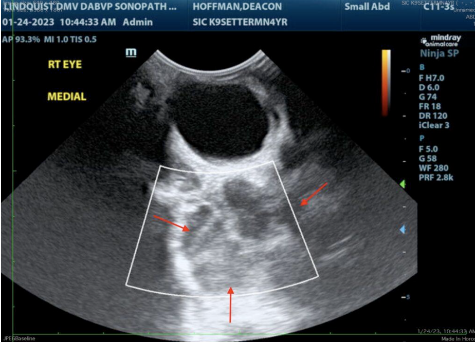 April Case of the Month - SonoPath
