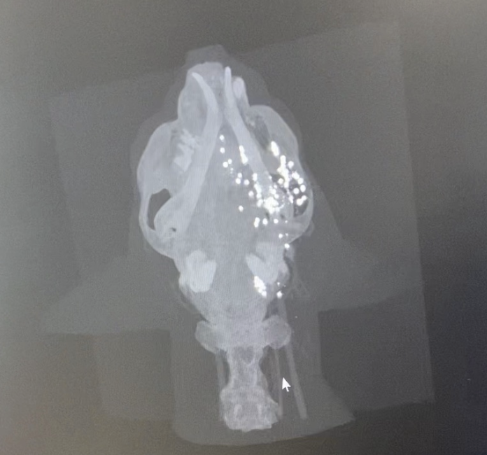 Large Subtentorial Extraaxial Intracranial Mass: our Case of the Month ...