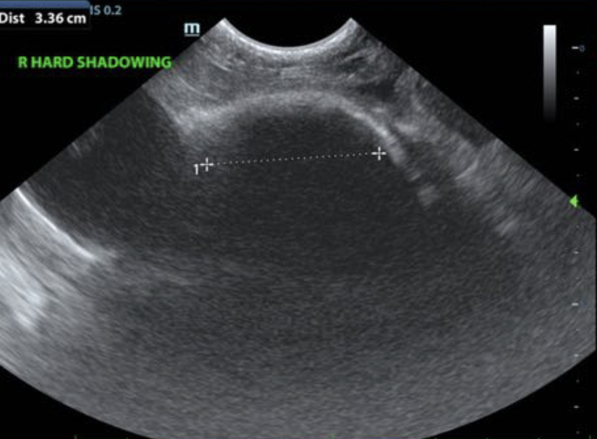 Cranial Mediastinal Cyst and Hepatic Cyst with Urinary Bladder Calculus ...