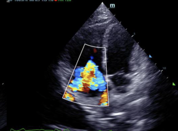 In-Hospital SDEP® Training - SonoPath