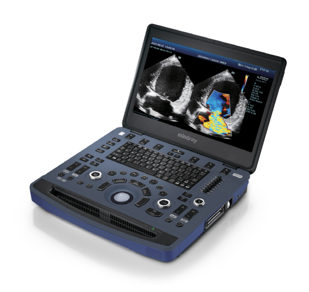 The M11 ultrasound system - SonoPath