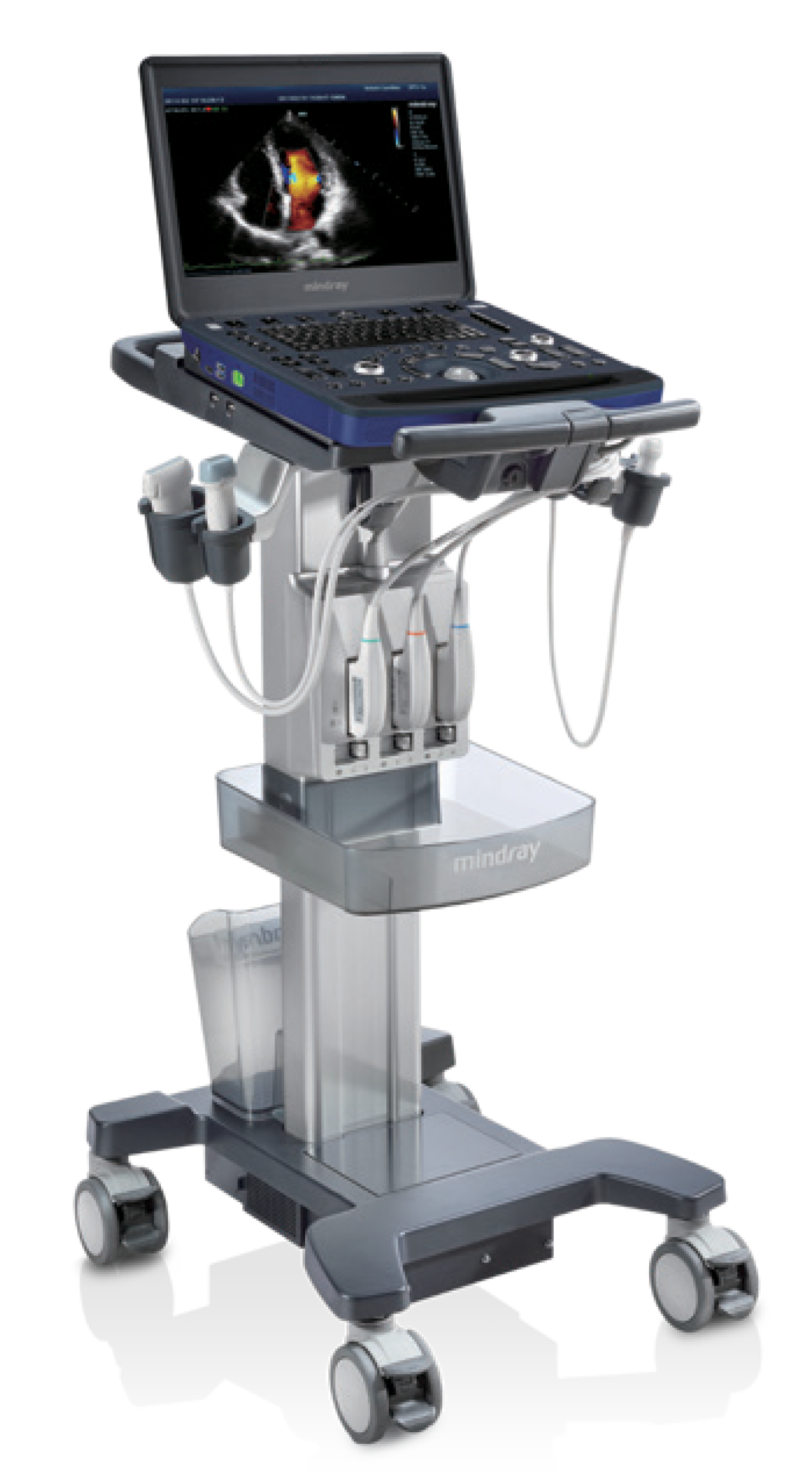 The M11 ultrasound system - SonoPath
