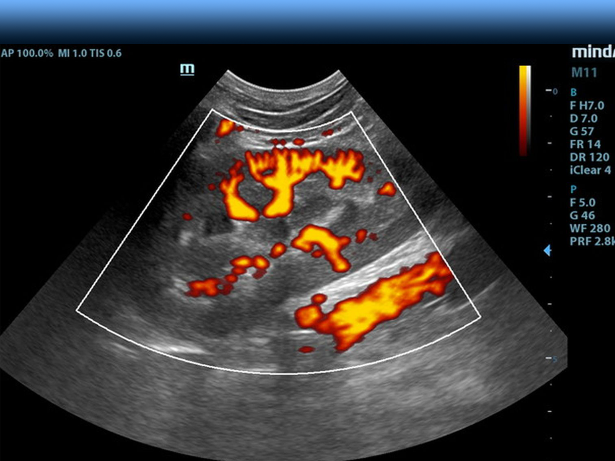 The M11 ultrasound system - SonoPath