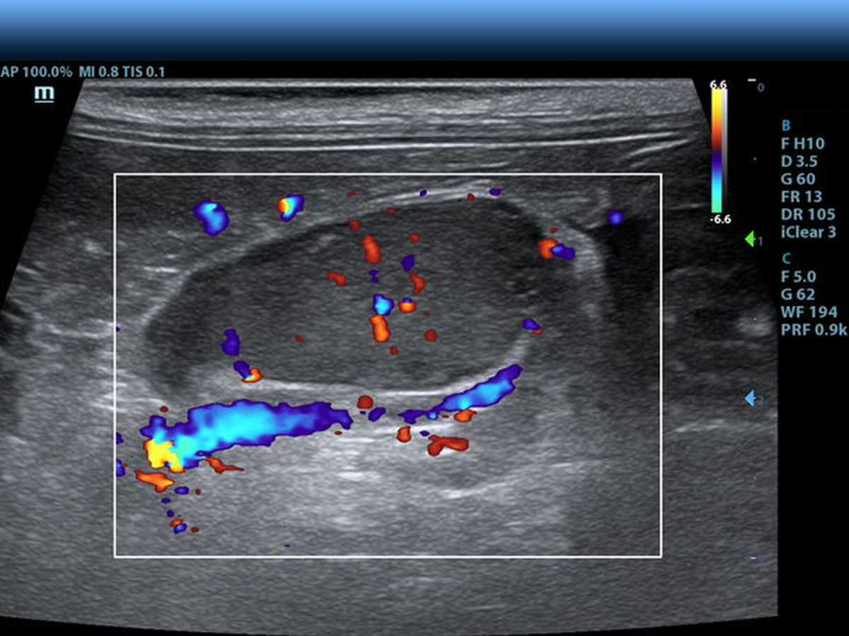 The M11 ultrasound system - SonoPath