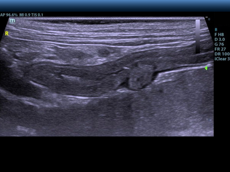 The M11 ultrasound system - SonoPath