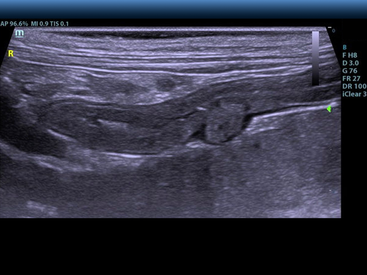 The M11 ultrasound system - SonoPath
