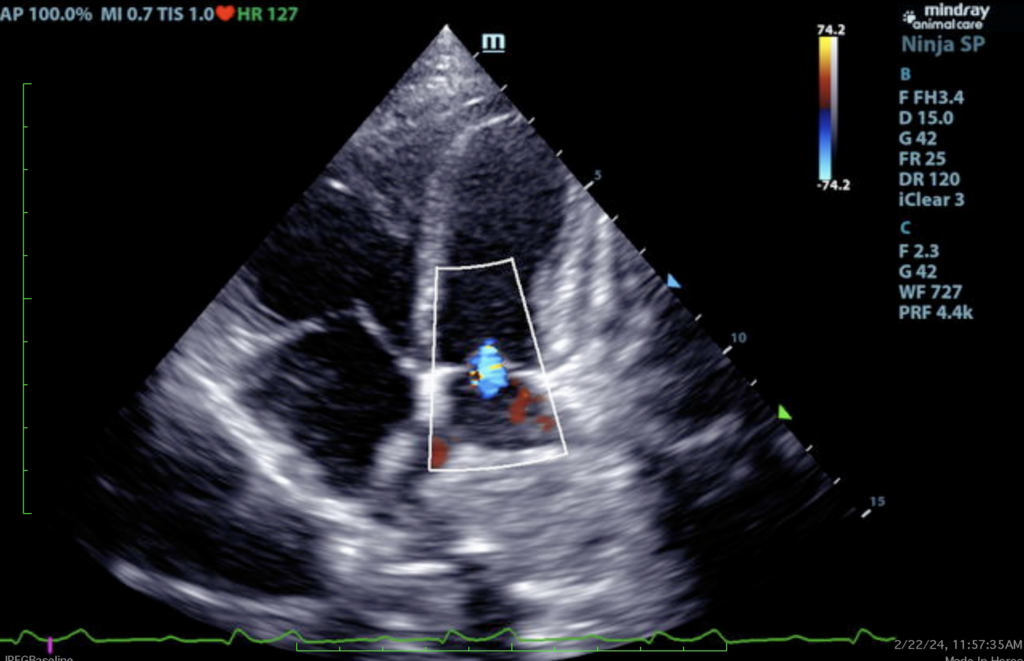 Fungal Granuloma causing Mass Lesion in Pulmonary Artery of a 1-year ...
