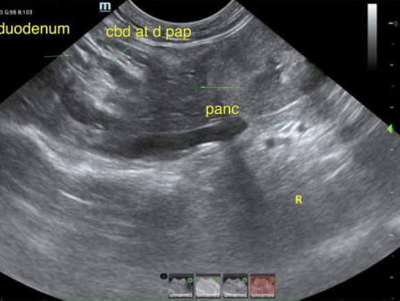 Post-Hepatic Obstruction in a 13-year-old MN DSH Cat - Friday Night ...