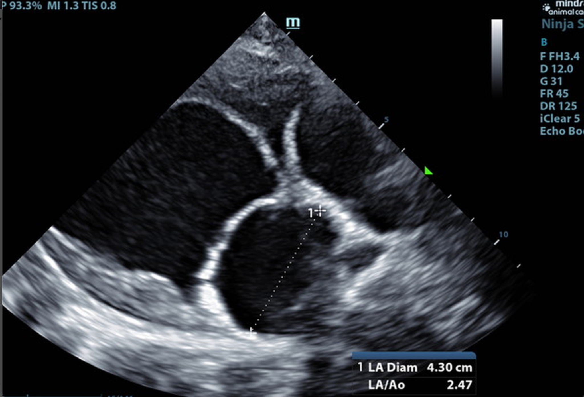 The M11 ultrasound system - SonoPath