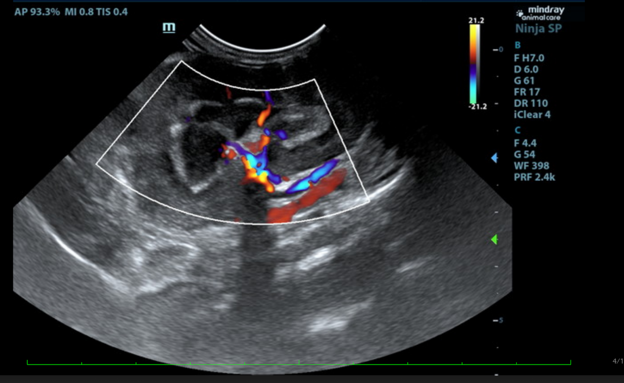 The M11 ultrasound system - SonoPath
