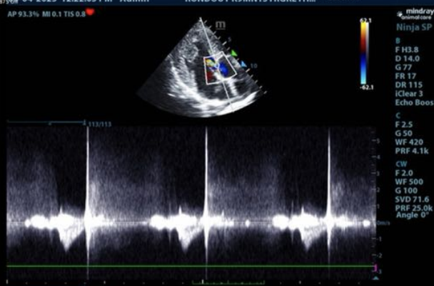 The M11 ultrasound system - SonoPath