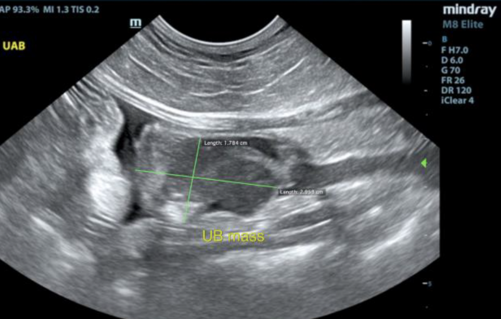 Urinary Bladder Neoplasia and Rupture in a 12-year-old Domestic ...