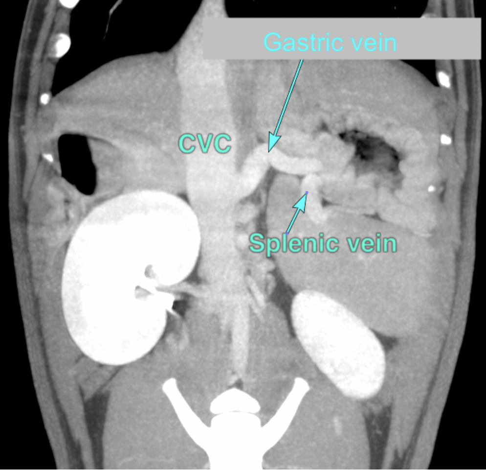 Extrahepatic Portosystemic Shunt in a 1.5-Year-Old Intact Male Shih-Tzu ...