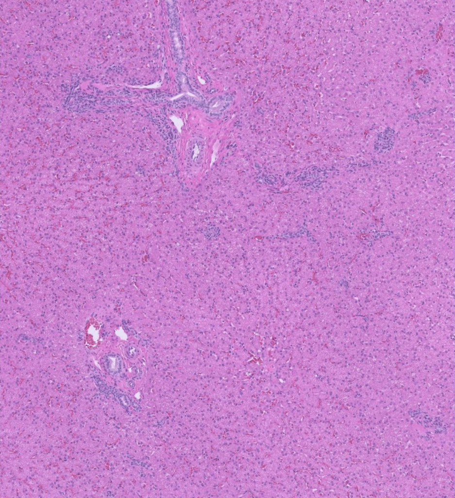 Extrahepatic Portosystemic Shunt in a 1.5-Year-Old Intact Male Shih-Tzu ...