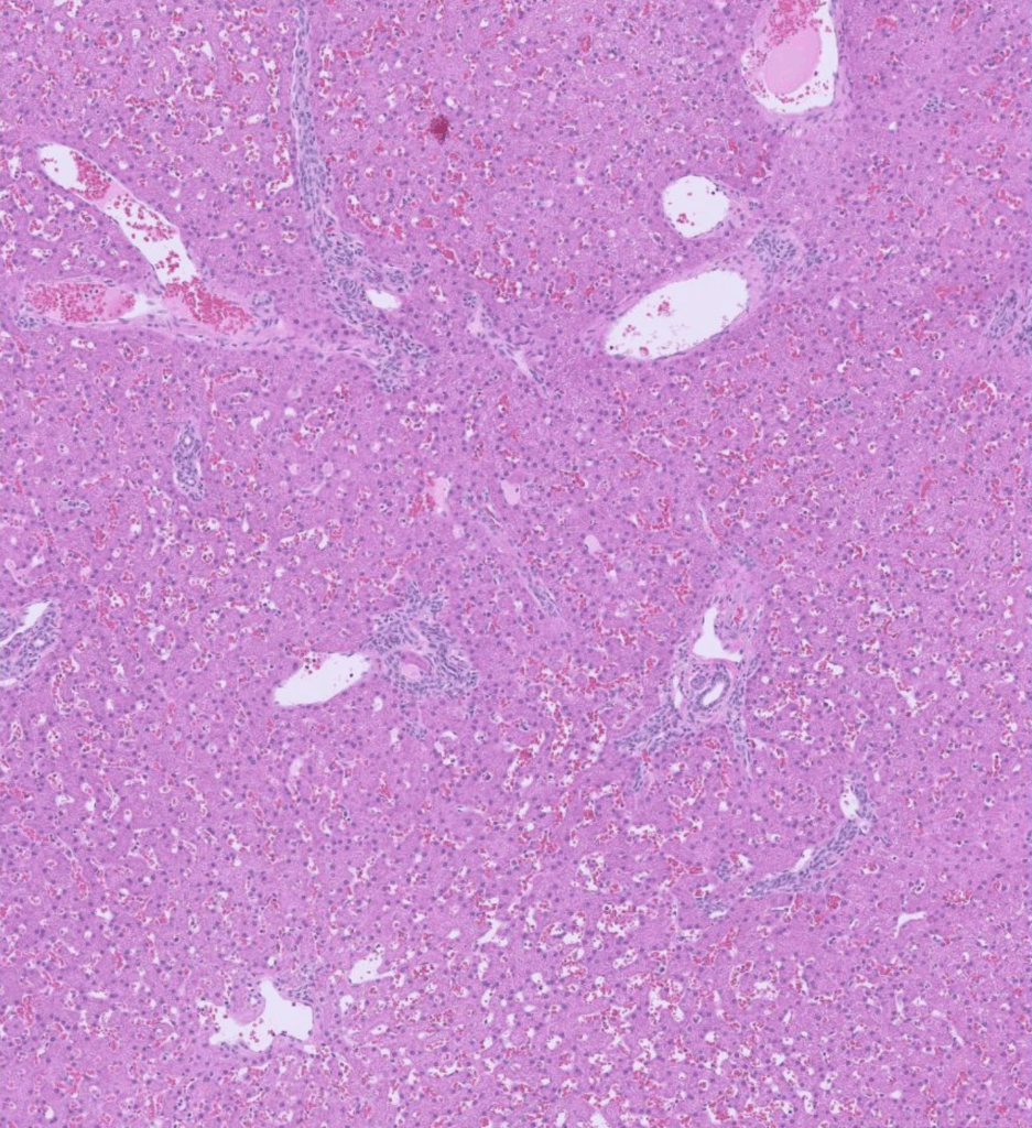 Extrahepatic Portosystemic Shunt in a 1.5-Year-Old Intact Male Shih-Tzu ...